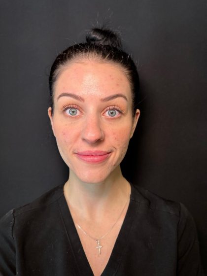 Patient #8083 Neurotoxin Before and After Photos Austin, TX - Plastic ...